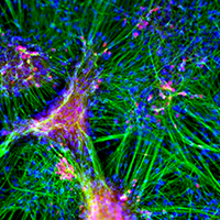How a protein collaboration builds the brain - A*STAR Research