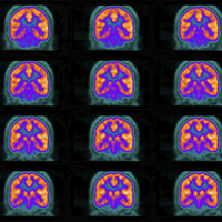 Imaging the brain’s energy usage - A*STAR Research