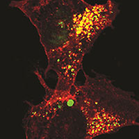 Protein induces self-destruction in cancer cells - A*STAR Research