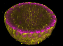 Treating disorders that get under your skin - A*STAR Research