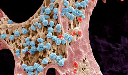 Monocytes make a team effort in the bone marrow - A*STAR Research