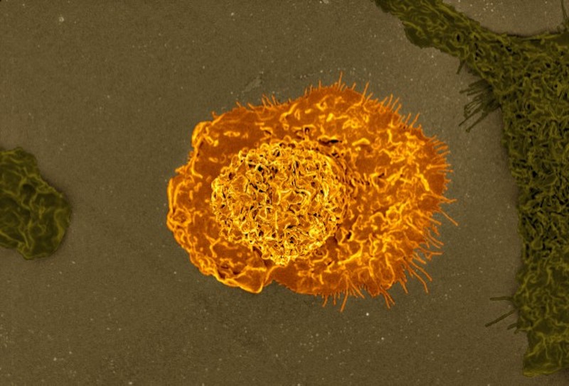 A fatal flaw in the immune system - A*STAR Research