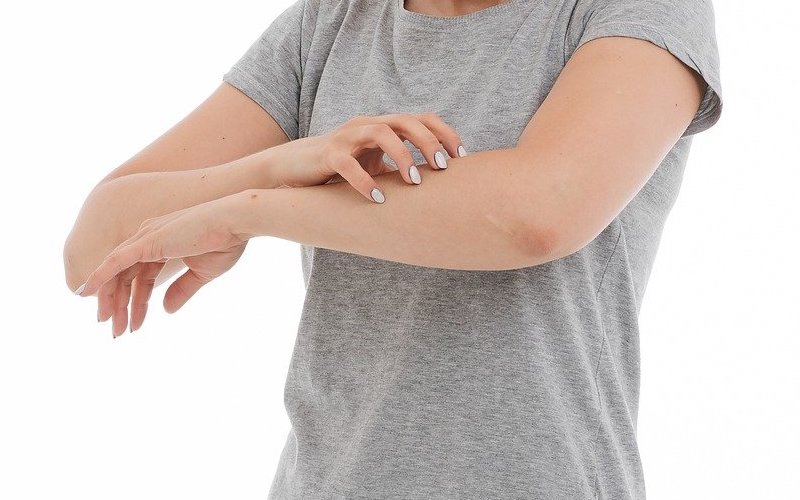 Repurposing a cancer drug for eczema - A*STAR Research