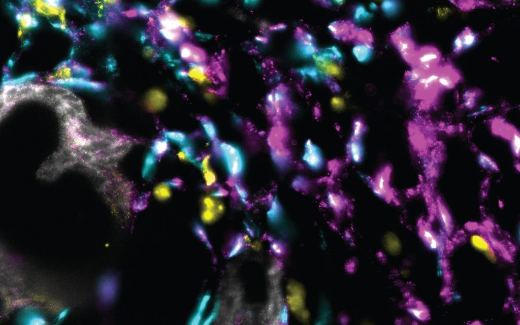 FISHing for answers in gene clusters - A*STAR Research